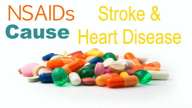 This Just In: FDA Says NSAIDs Cause Stroke and Heart Disease